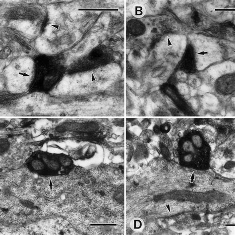 A D Ultrastructural Appearance Of Synaptic Contacts Found In The Download Scientific Diagram