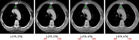 CT Scans Through Different HU Window Widths When The Window Level Is Download Scientific