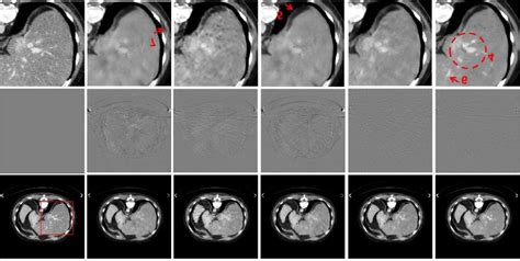 Visualizations Of Sparse View Reconstruction In Case 2 By Using