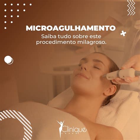 Saiba Mais Sobre O Procedimento Estético De Microagulhamento Capaz De