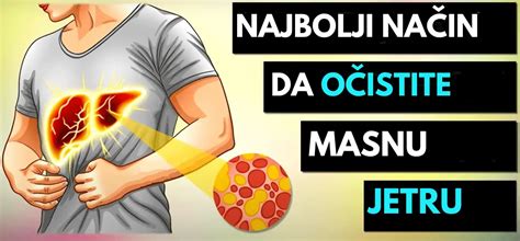 Masna Jetra Evo Kako Brzo Da Je Izlečite Vaš Doktor