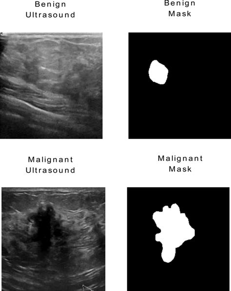 Some Sample Images From The Busi Dataset Download Scientific Diagram