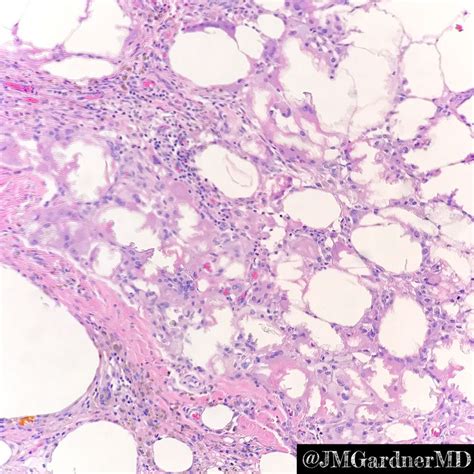 Varna Menon Md Frcpath Varnamenon Twitter