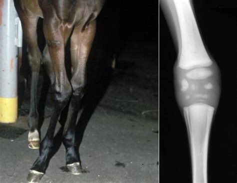 Angular Limb Deformities Congenital Or Acquired Skeletal Defects