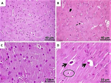 Representative Photomicrographs Of Histological Sections Stained With
