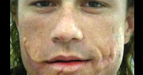 Heath Ledger Test Photo With Joker Prosthetics But No Makeup Imgur