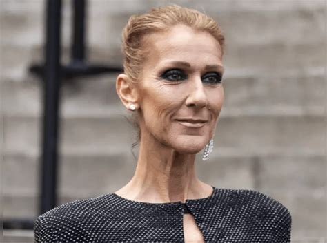 بیماری سلین دیون چیست؟ مجله ژنتیک پارس ژنوم