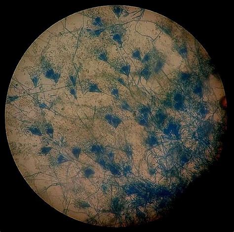 Shaima Mohamed On Linkedin Penicillium Spp 😍