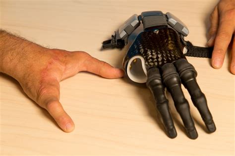 Prosthetic Technology Arm Dynamics