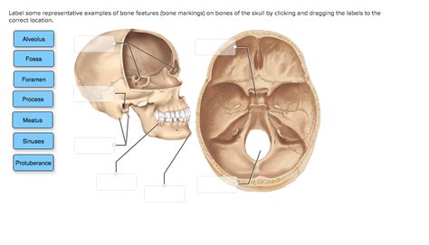 Solved Label Some Representative Examples Of Bone Features