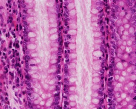 Gastrointestinal Tract Colon Histology Embryology