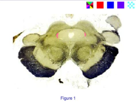 Trigeminal System Flashcards Quizlet