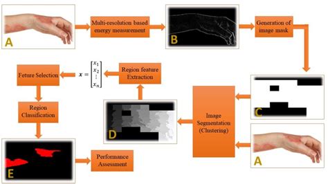 Roberto Rosas Romero On Linkedin Detection And Classification Of Skin Burns On Color Images Using…