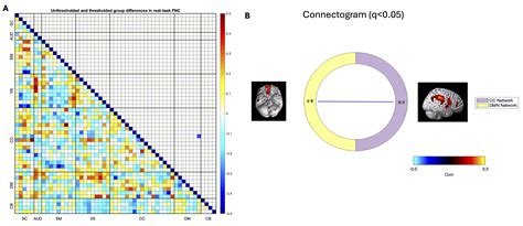 Fully Automated Estimation Of Fmri Guided Spect Brain Networks And
