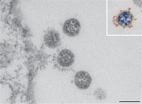 Electron Microscopy Images And Morphometric Data Of Sars Cov 2 Variants