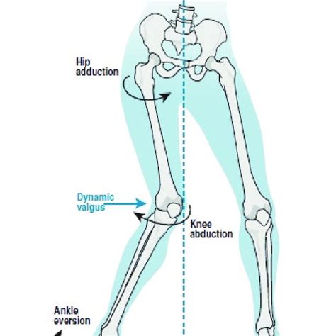 Pdf Effect Of Muscle Energy Technique On Upslip And Inflare