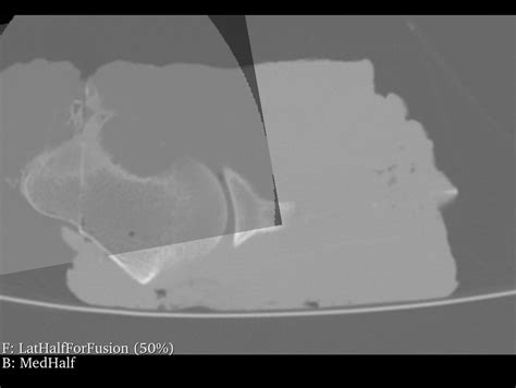 Stitching Adjacent But Not Overlapping Ct Volumes Support 3d Slicer Community