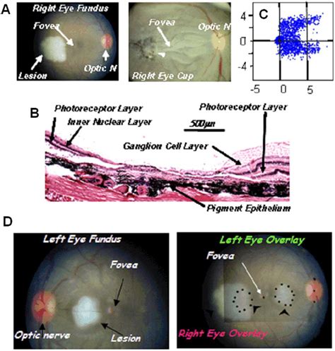 Microstimulation Of Visual Cortex To Restore Vision Pmc