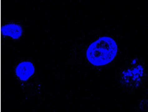 Why Cell Size Increases After Transfection With Lipofectamine 2000