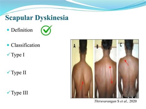 Scapular Dyskinesispptx Death Injury Or Military Conflict