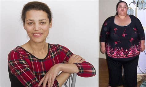 Should The Nhs Remove Emma Sealey Saggy Skin After She Lost 20st By