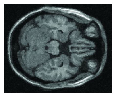 comparative images a without shift invariant filtering b with download scientific diagram