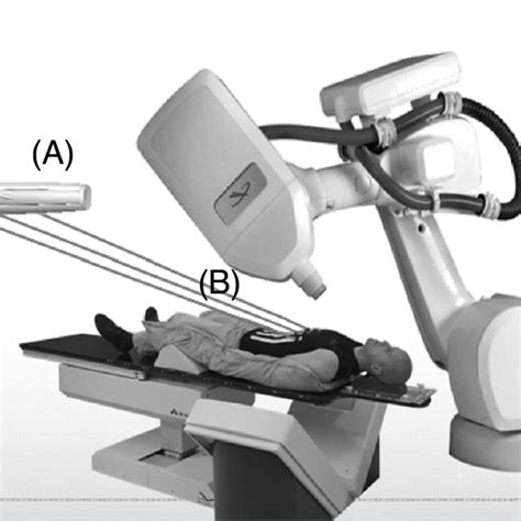 Pdf Stereotactic Body Radiation Therapy