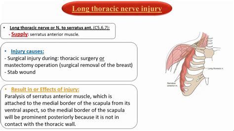 Long Thoracic Nerve Thoracodorsal Nerve