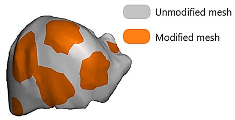 Fractal Analysis And Fem Assessment Of Soft Tissue Affected By Fibrosis