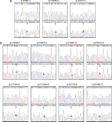 Figure 2 From Functional Genetic Variants Of The Gata4 Gene Promoter In Acute Myocardial