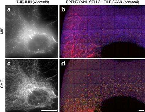 Microscopy Fluorescencefriday Cellbiology Science Imaging