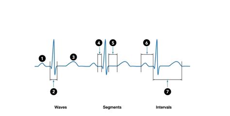 The Waveforms Segments And Intervals Of An Ecg Diagram Quizlet