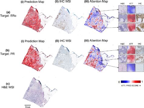 figure 3 from deep learning models predicting hormone receptor status