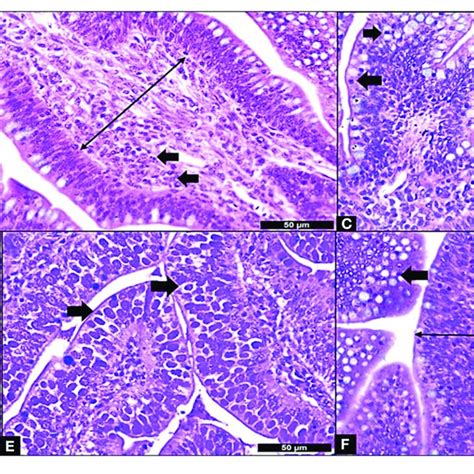 Microscopic Enteritis Components And Isi Parameters A Normal