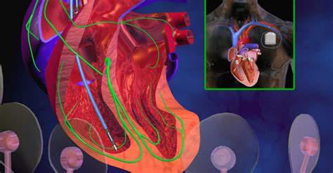 Hart En Bloedsomloop Plus Magazine
