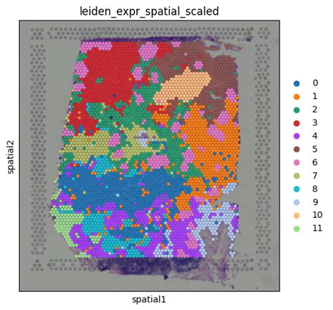 Exploring Spatial Transcriptomics A Dive Into Visium Data Analysis In Python Chatomics