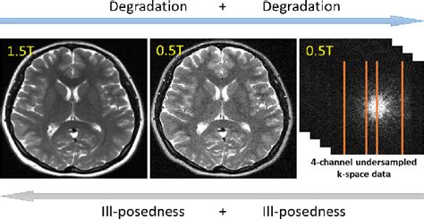 Figure 1 From Meta Learning Enabled Score Based Generative Model For 15t Like Image
