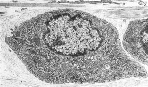 Fibroblast Tem Stock Image C054 9294 Science Photo Library