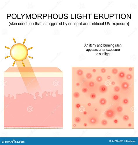 Polymorphic