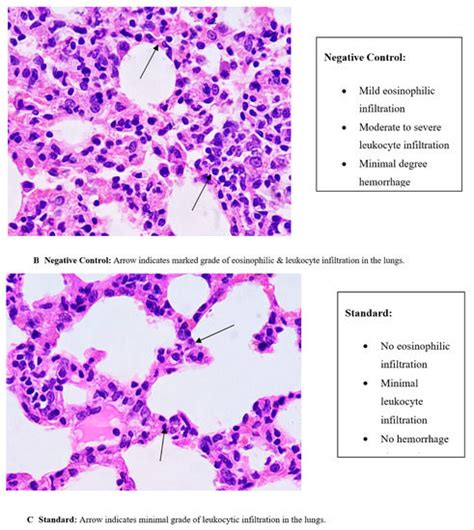 Sinusitis An Open Access Journal From MDPI
