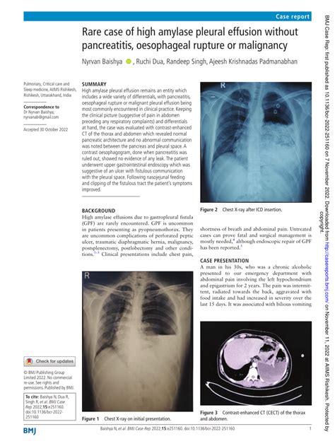 Pdf Rare Case Of High Amylase Pleural Effusion Without Pancreatitis