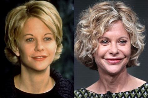 Meg Ryans Before And After Plastic Surgery Photos Should Warn People