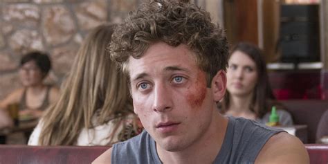 10 Times Shameless Broke Our Hearts