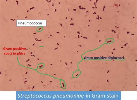 Pneumococcus Introduction Morphology Pathogenecity Laboratory