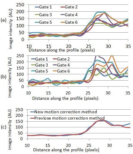 Profiles From Different Respiratory Gated Frames Using Sinogram Domain Download Scientific
