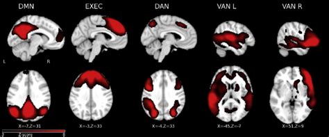 E Task Positive And Task Negative Networks For All Groups As Revealed Download Scientific