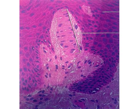 Tactile Corpuscles Receptor Quiz