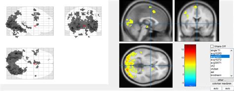 基于dpabi和spm12的任务态fmri分析笔记2——统计检验fmri任务态分析 Csdn博客