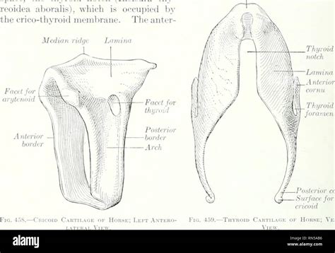 Thyroid Notch