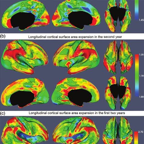 The Respective Distribution Of Longitudinal Cortical Surface Areas Of Download Scientific